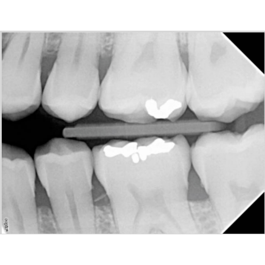 Rendgen aparat - X-MIND UNITY| Stomatološki materijal i oprema